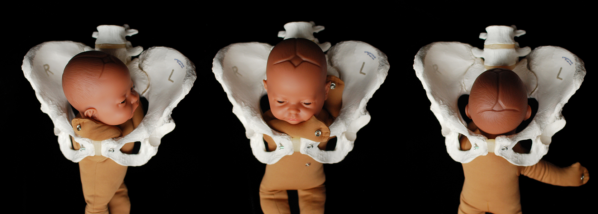 Mechanics Of Breech Birth how Does Breech Birth Work mechanics-of-breech-birth-how-does-breech-birth-work